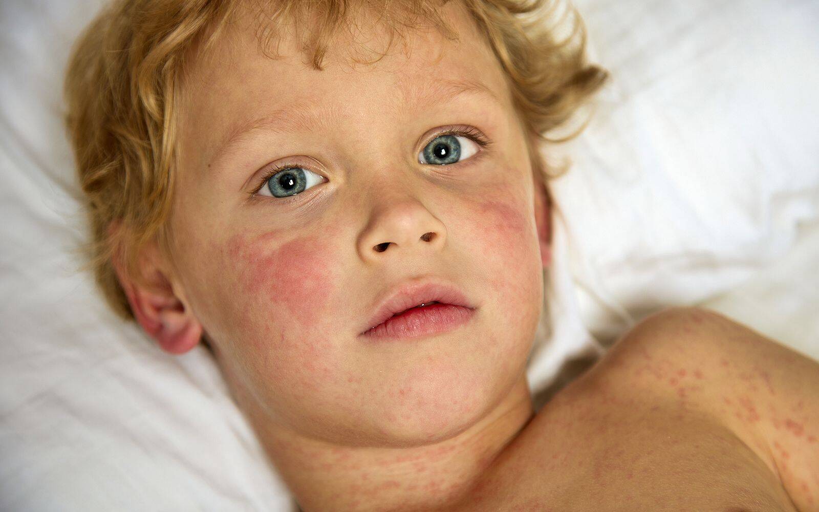 Navigating the Hazards: cross-contamination & Nut Allergies - Nutracelle